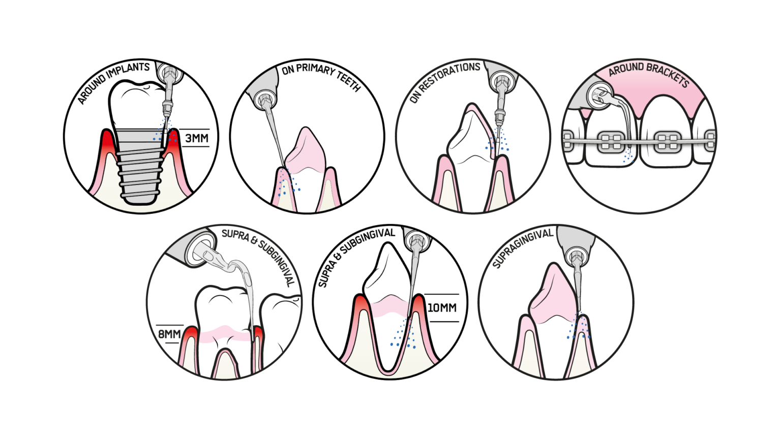 GBT 06 PIEZON® - EMS - AIRFLOW® Dental Spa